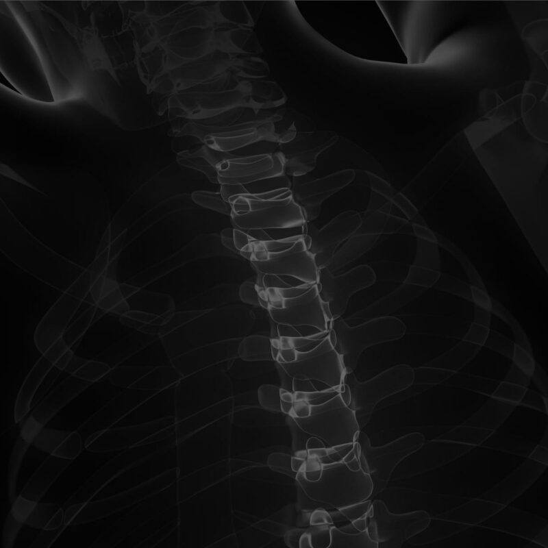 Courses Archives - Spinal Hygiene Products